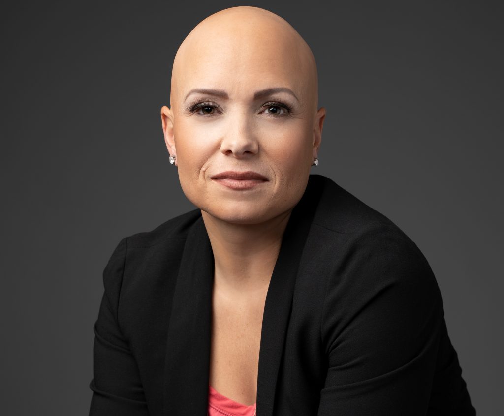 McKenna Reitz: How I turned the drama of hair loss into strength ...